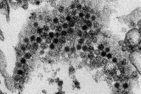 The Health 202: Trump's next target in bid to lower health-care costs ...